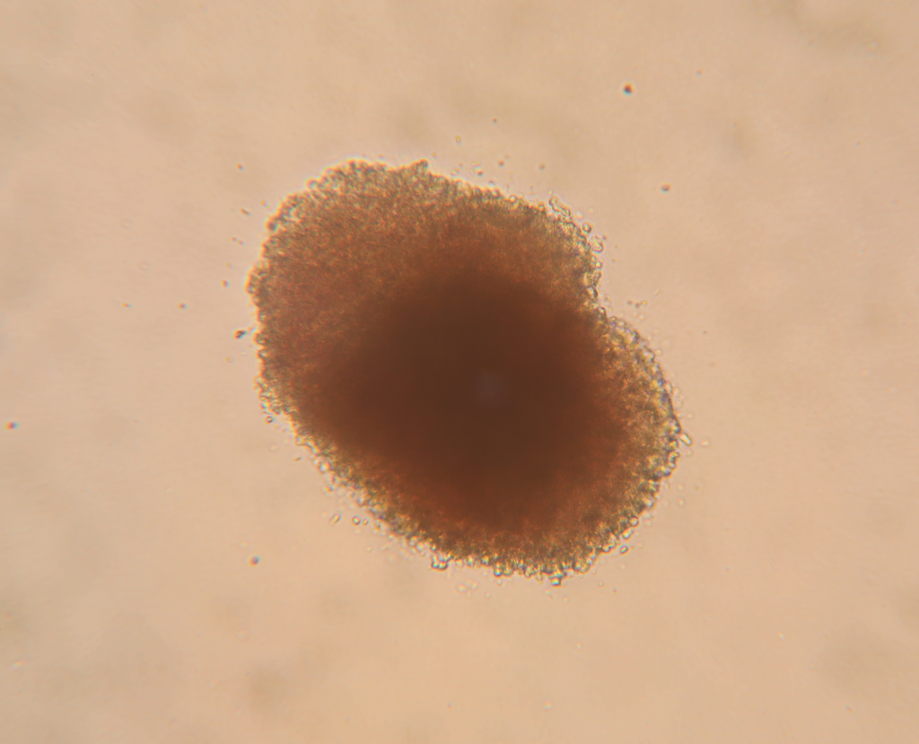 Myeloid and Erythroid Hematotoxicity CFC Assay | Discovery Life Sciences
