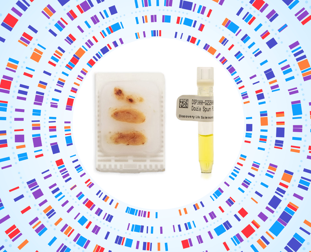 SpecimenSeq™ FFPE & Plasma Matched Sets | Discovery Life Sciences