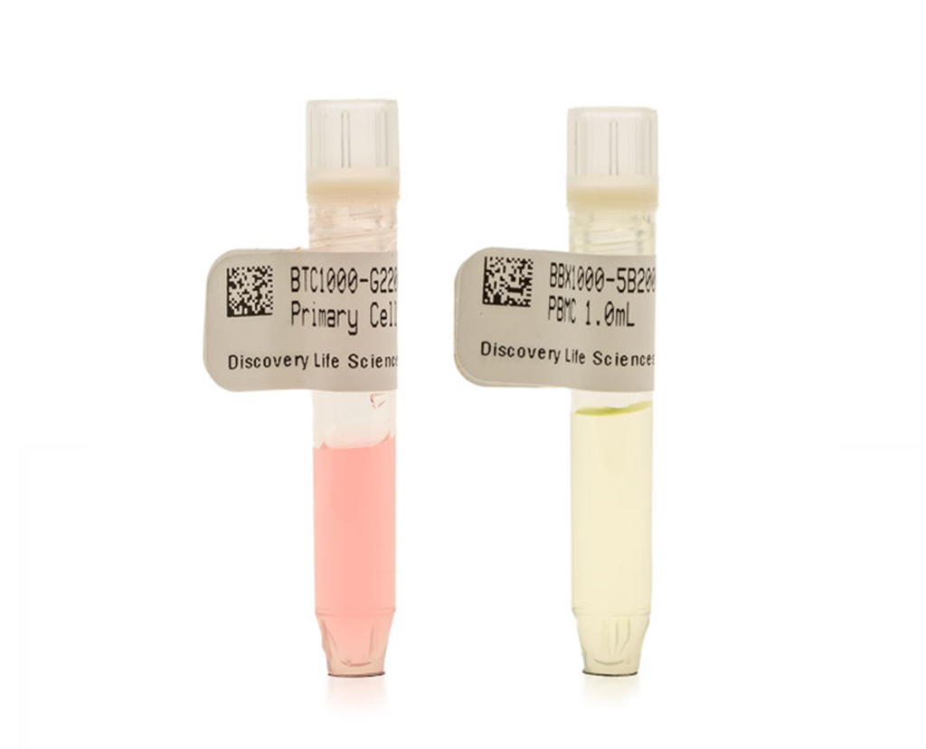 Matched CancerSample Sets | Discovery Life Sciences