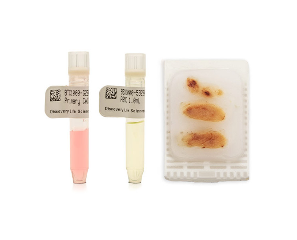 Peripheral Blood Mononuclear Cells (PBMCs) | Discovery Life Sciences