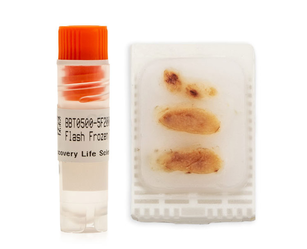 Human Tissue Samples | Discovery Life Sciences