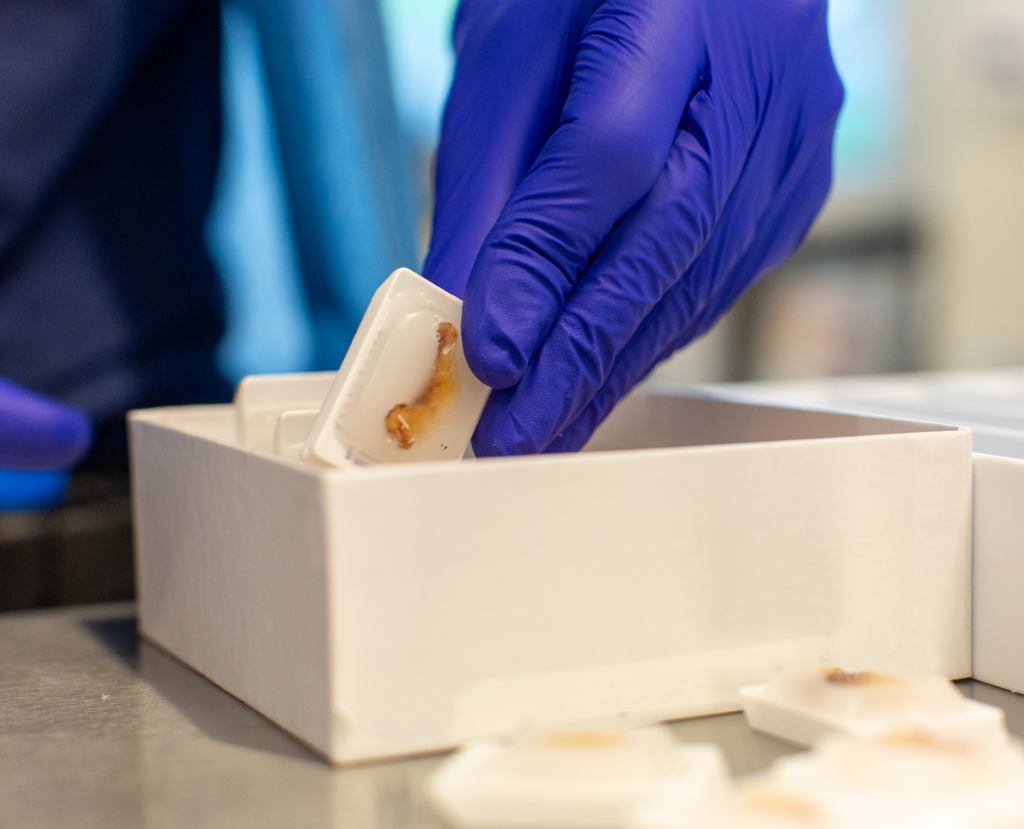 Formalin-Fixed Paraffin-Embedded (FFPE) Tissue | Discovery Life Sciences