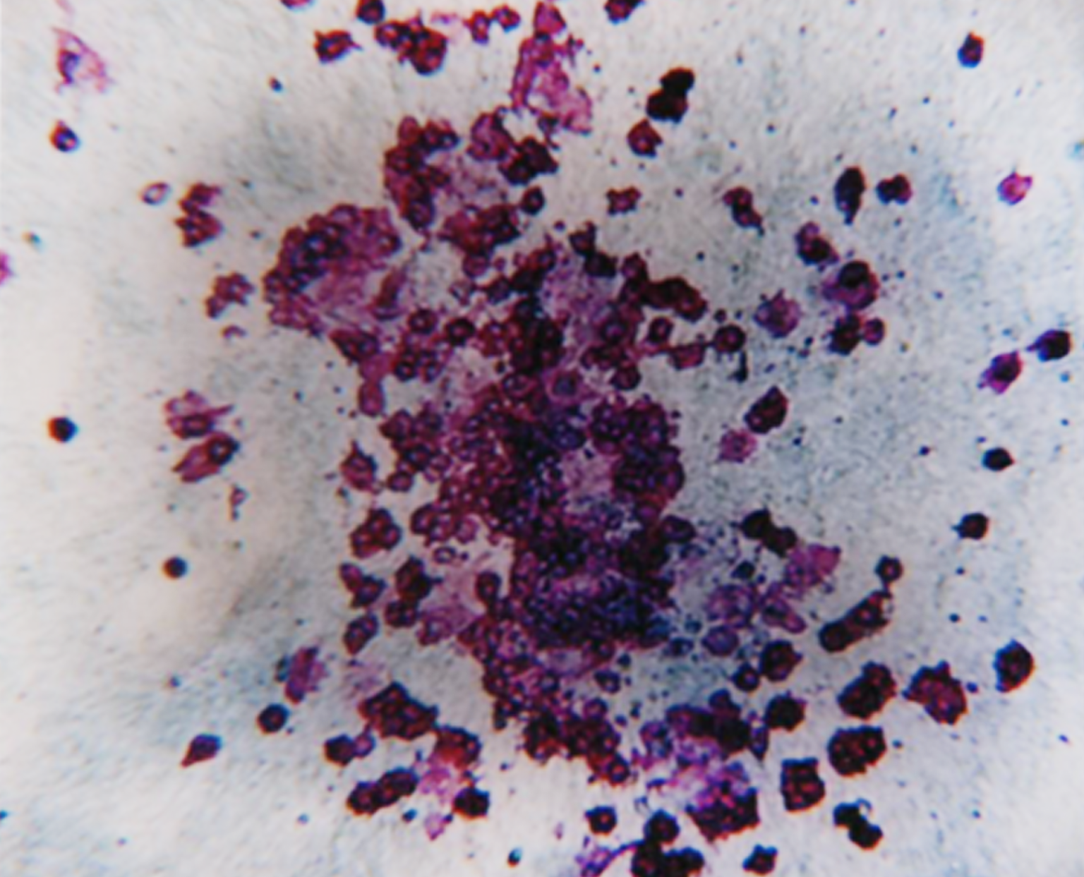 Megakaryocytic Hematotoxicity CFC Assay Service | Discovery Life Sciences