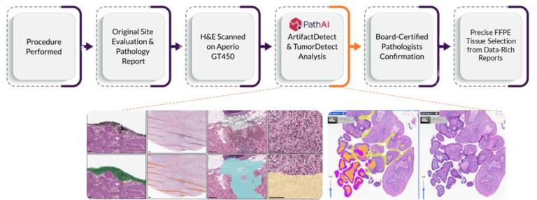 Formalin-Fixed Paraffin-Embedded (FFPE) Tissue | Discovery Life Sciences