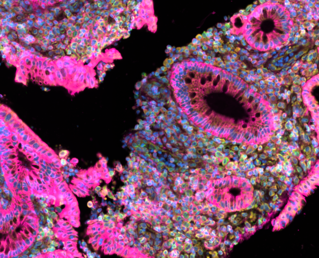 Spatial Gene Expression Sample Prep and Library Construction ...