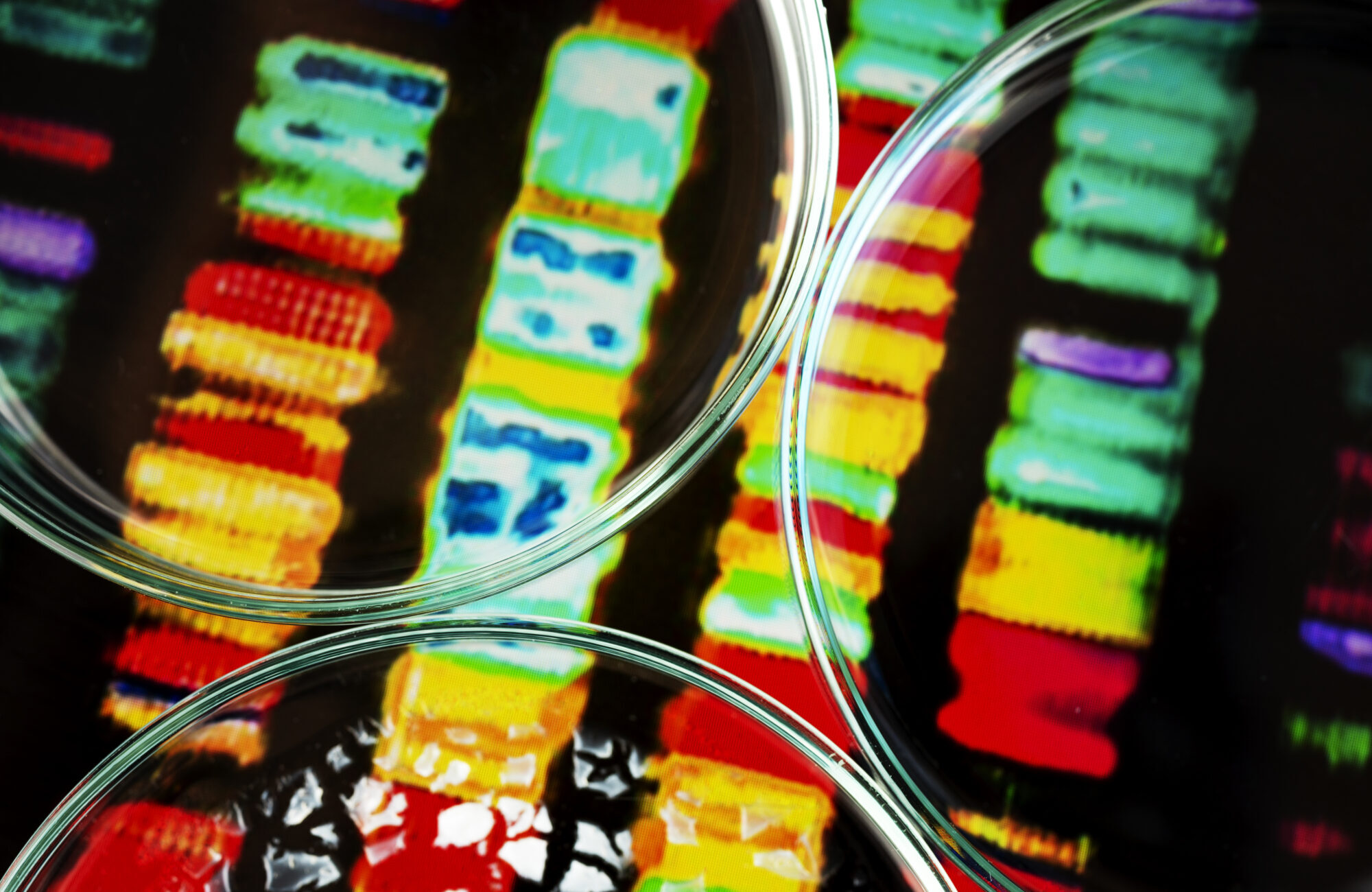 SpecimenSeq™ NGS-Characterized Biospecimens | Discovery Life Sciences